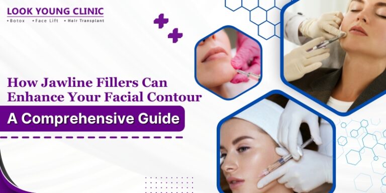 How Jawline Filler Treatment Enhances Your Facial Structure